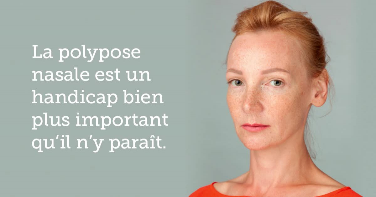 La polypose nasale avec Sanofy Genzyme | Futura